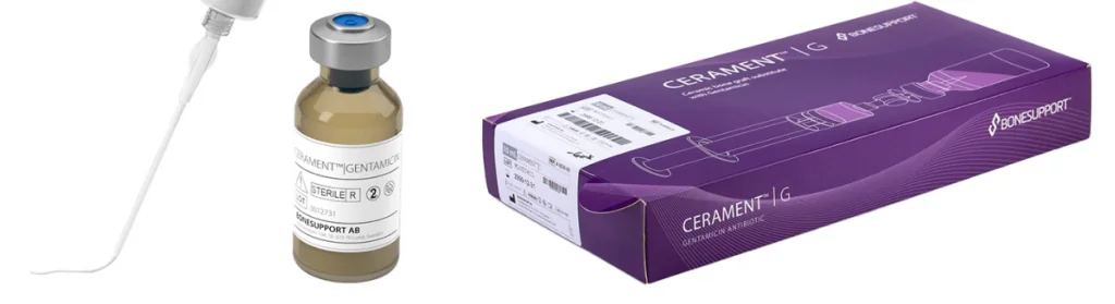 CERAMENT® G - CARE TECH SOLUTIONS