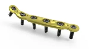 Clavicle Plating System – Fixation Products - CARE TECH SOLUTIONS