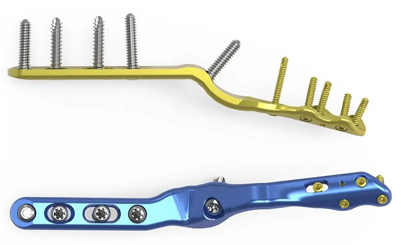 Hand & Wrist – Total Wrist Fusion Plating System - CARE TECH SOLUTIONS
