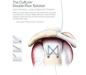 ORTHOPAEDIC SOLUTIONS – SHOULDER – PRODUCTS – Suture Anchors - CARE ...